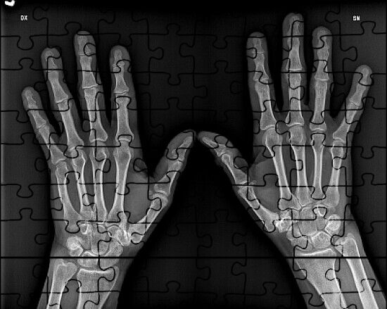 X-Ray Jigsaw Puzzles Online | JSPuzzles.com